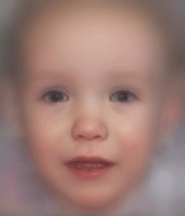 FDNA™ Joubert Syndrome: Key Symptoms, Causes, and Diagnosis