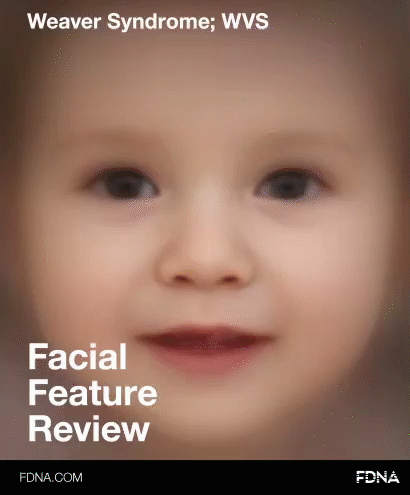 Syndrome Masks Archives - FDNA™