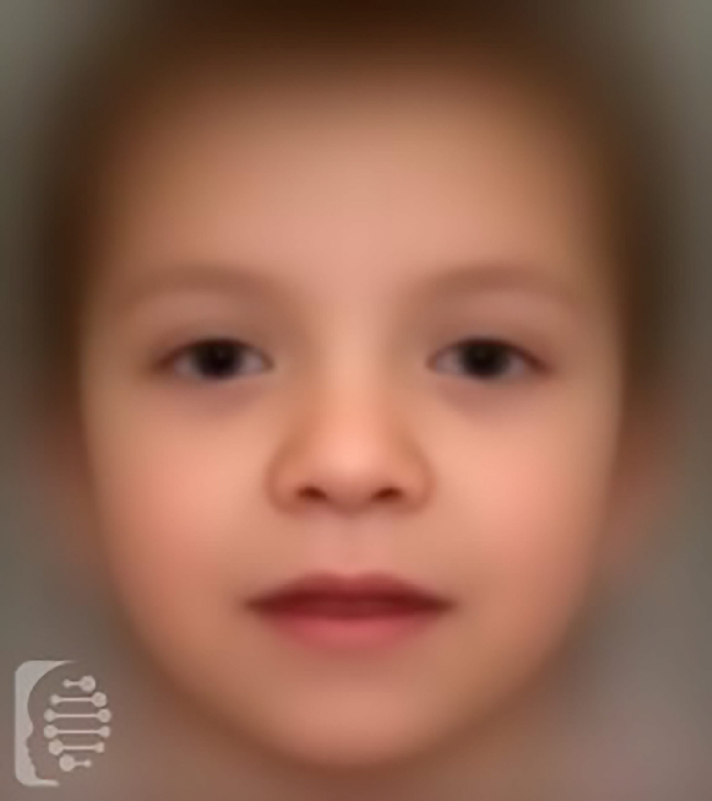 FDNA™ Noonan Syndrome: Key Symptoms, Causes, and Diagnosis