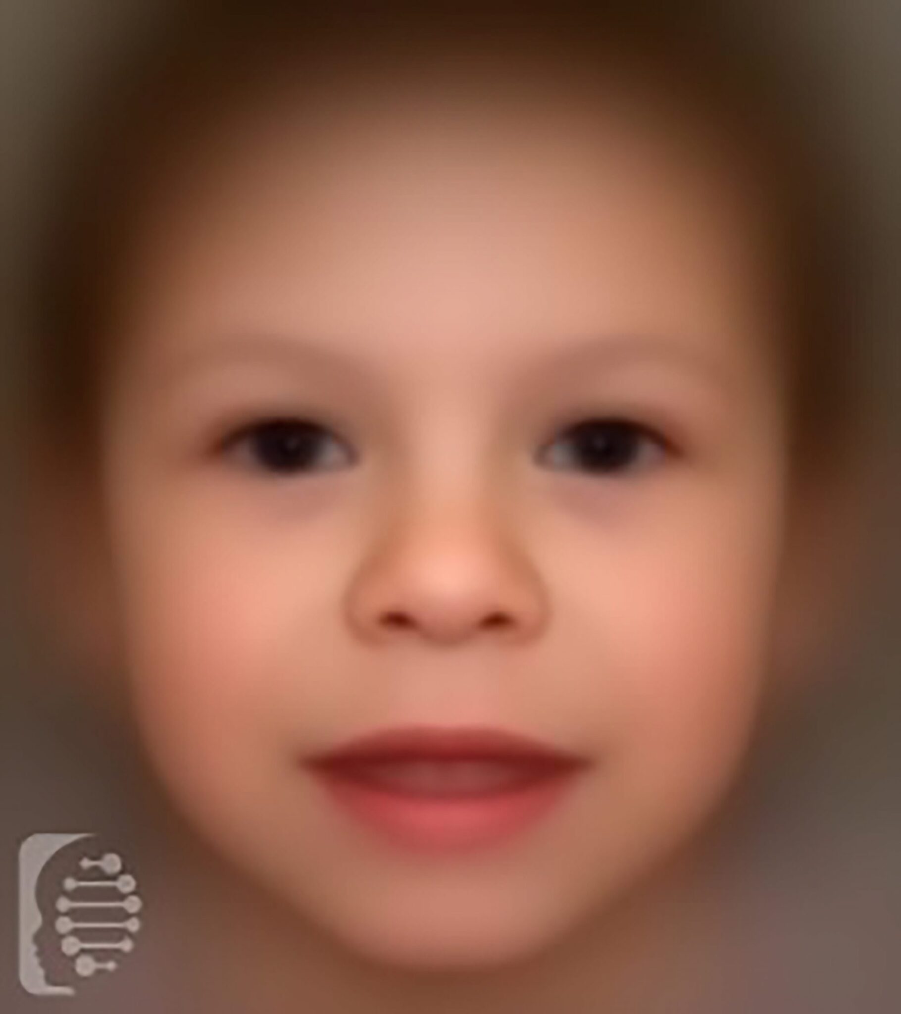 FDNA™ Williams Syndrome: Key Symptoms, Causes, and Diagnosis