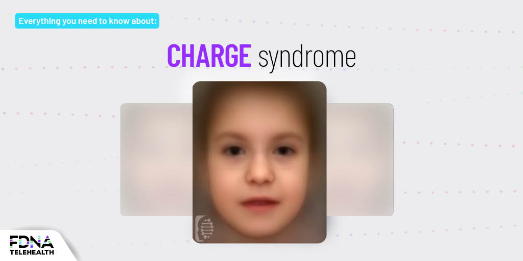 FDNA™ Charge syndrome: Key Symptoms, Causes, and Diagnosis