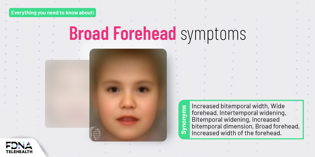 FDNA™ Broad Forehead in Children
