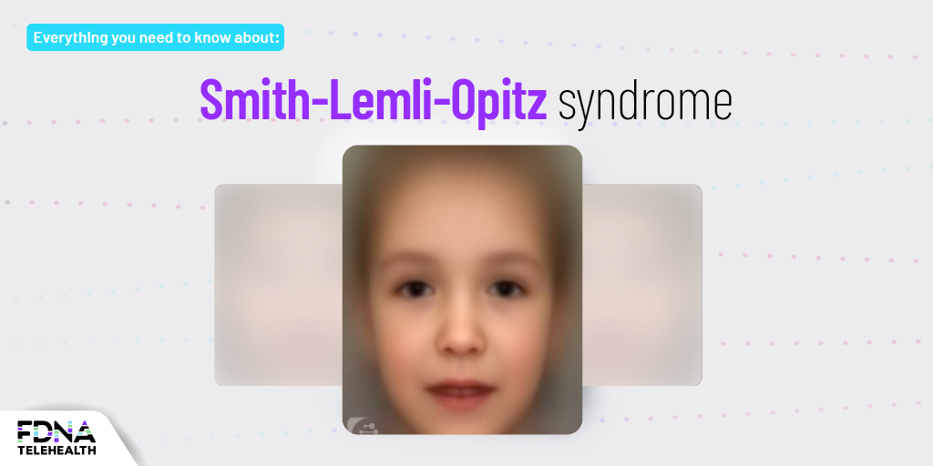 FDNA™ Smith-Lemli-Opitz Syndrome: Symptoms, Causes, and Diagnosis