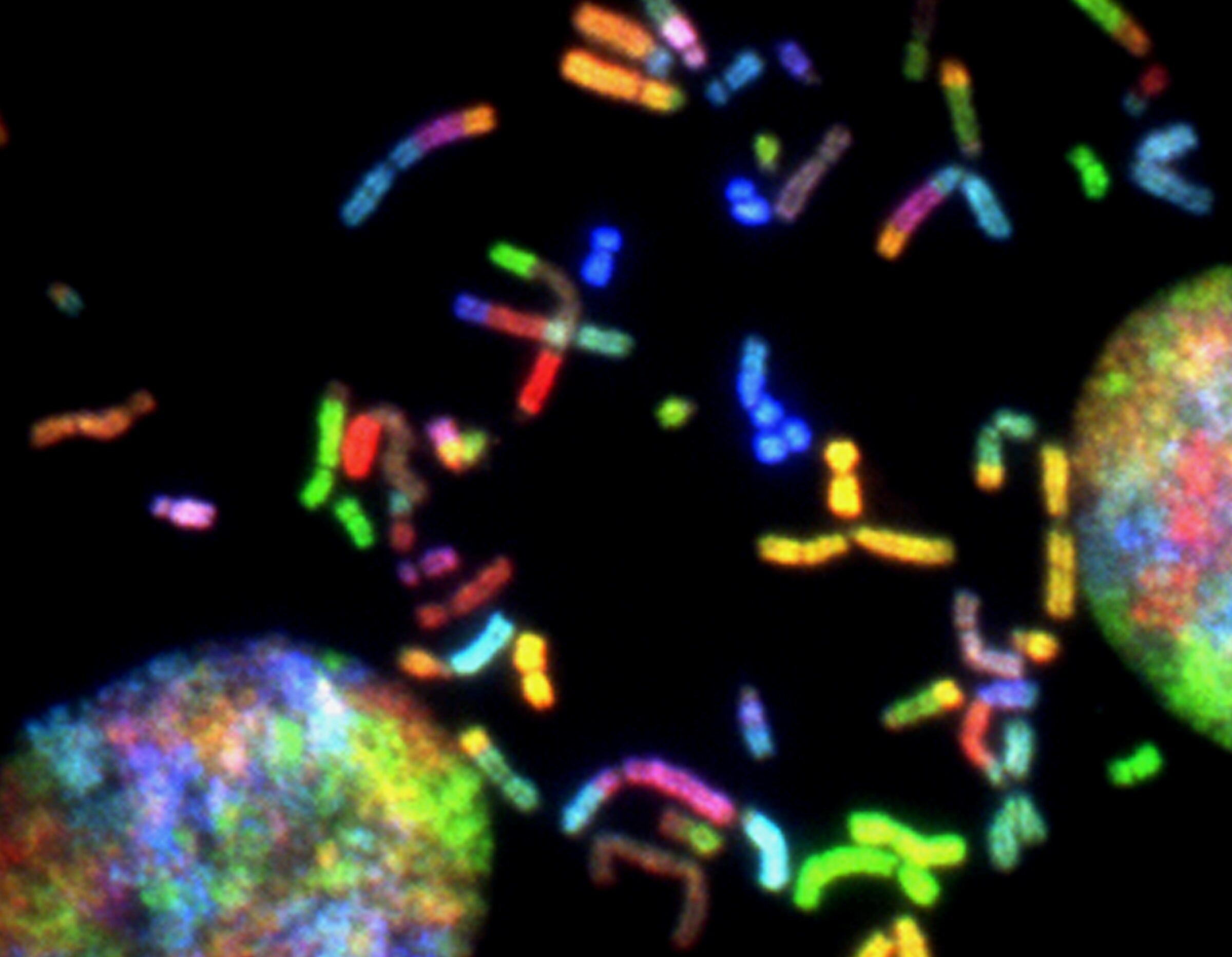 FDNA™ Role of Chromosomal Microarray in Diagnosing Genetic Conditions