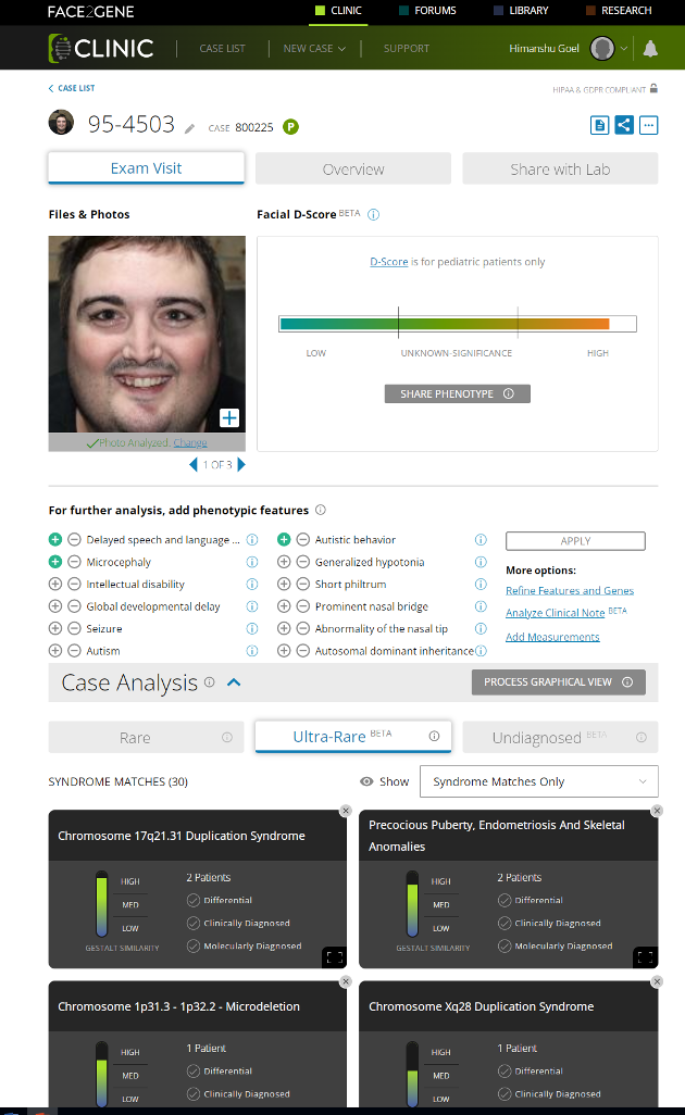 FDNA™ - Novo algoritmo da FDNA ajuda a diagnosticar paciente com ...