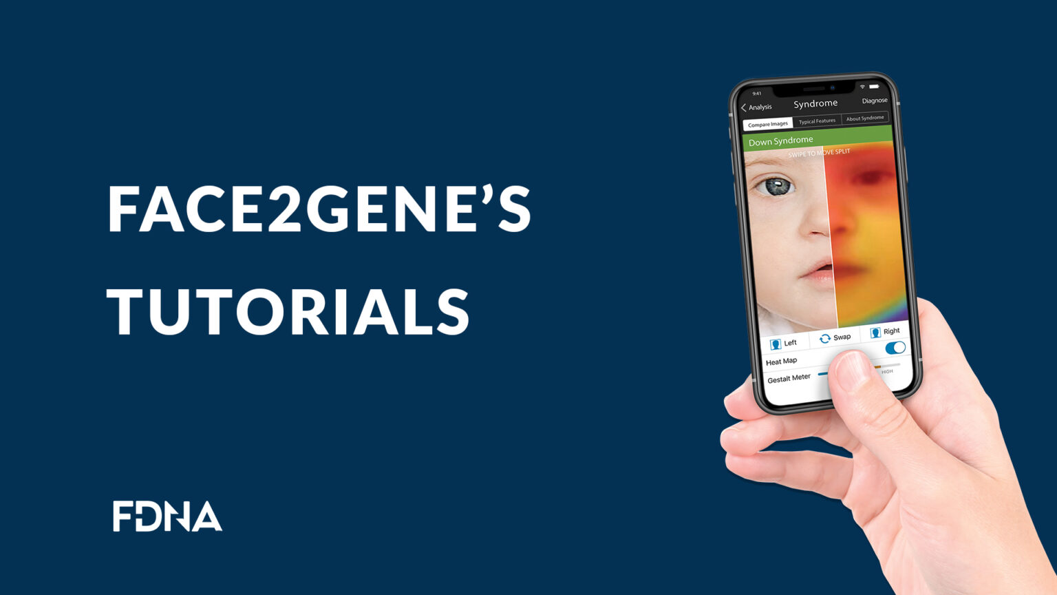 FDNA™ - Redefining Phenotyping for Variant Prioritization