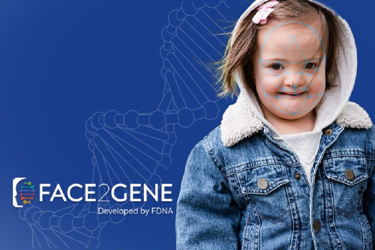 FDNA™ - Face2Gene Ends a 12-Year-Long undiagnosed KBG Syndrome