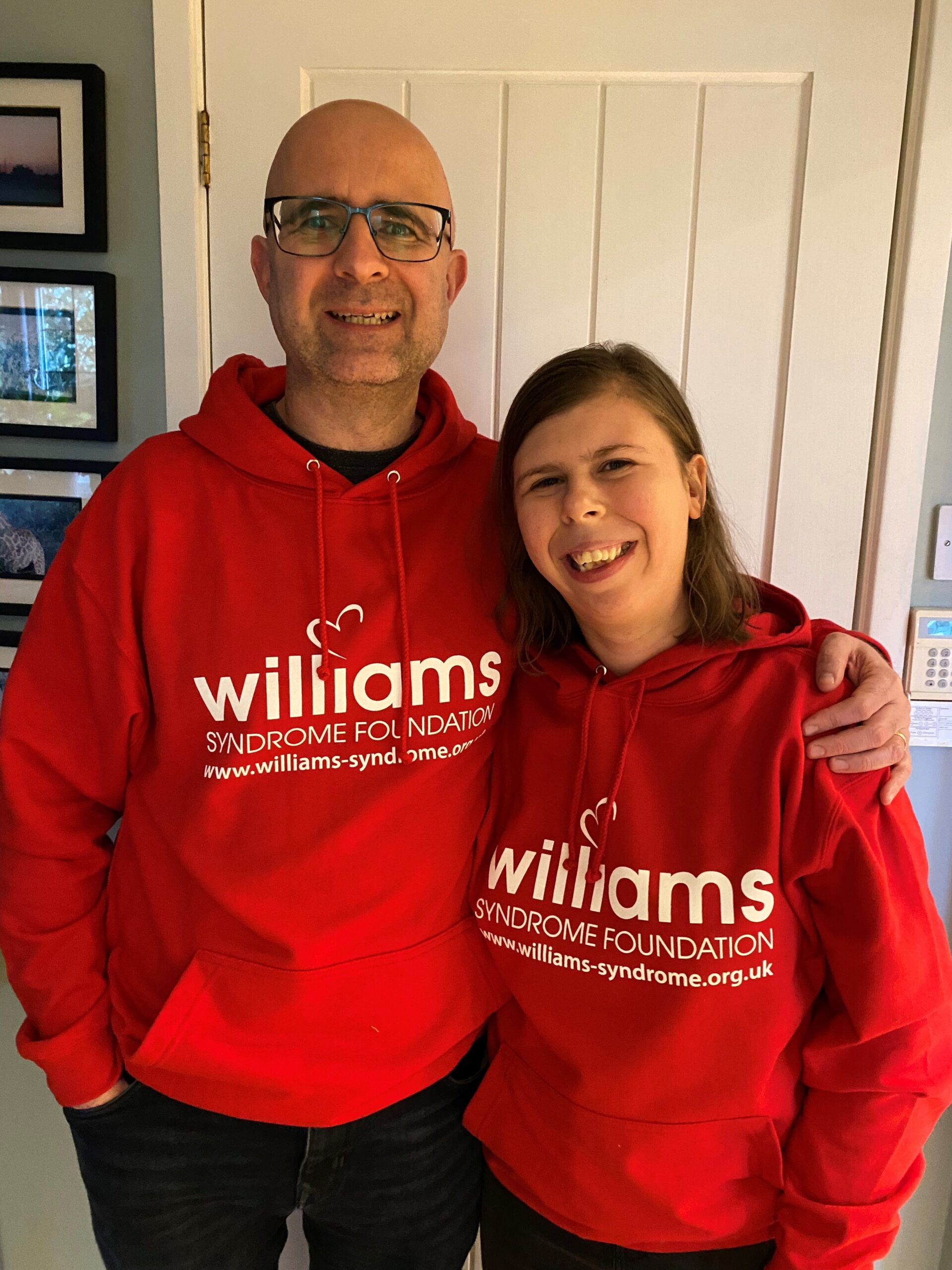 FDNA™ - Navigating the Diagnostic Odyssey of Williams Syndrome