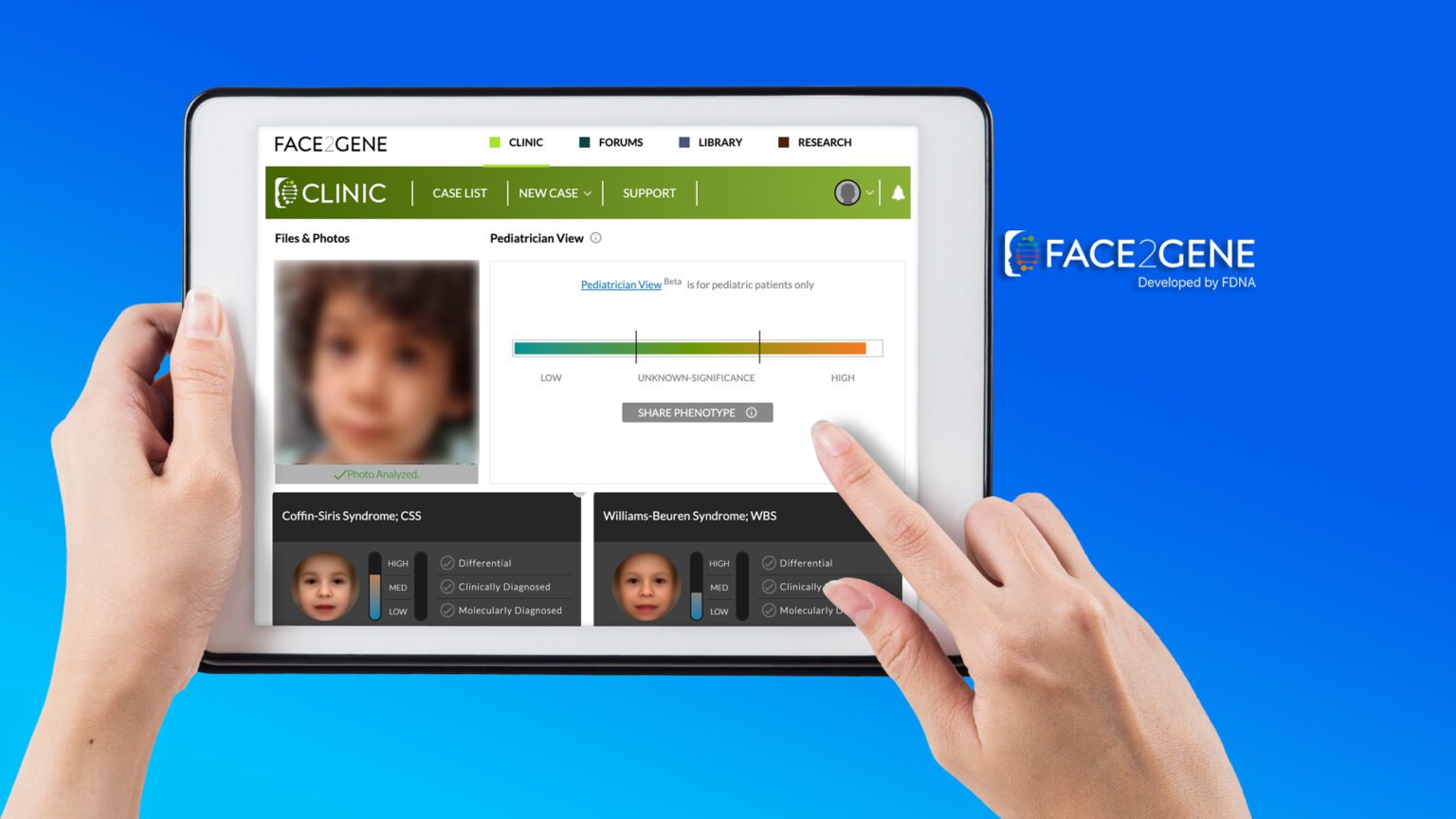 FDNA™ - Diagnosing Ultra-Rare Genetic Syndrome with FDNA AI Technology